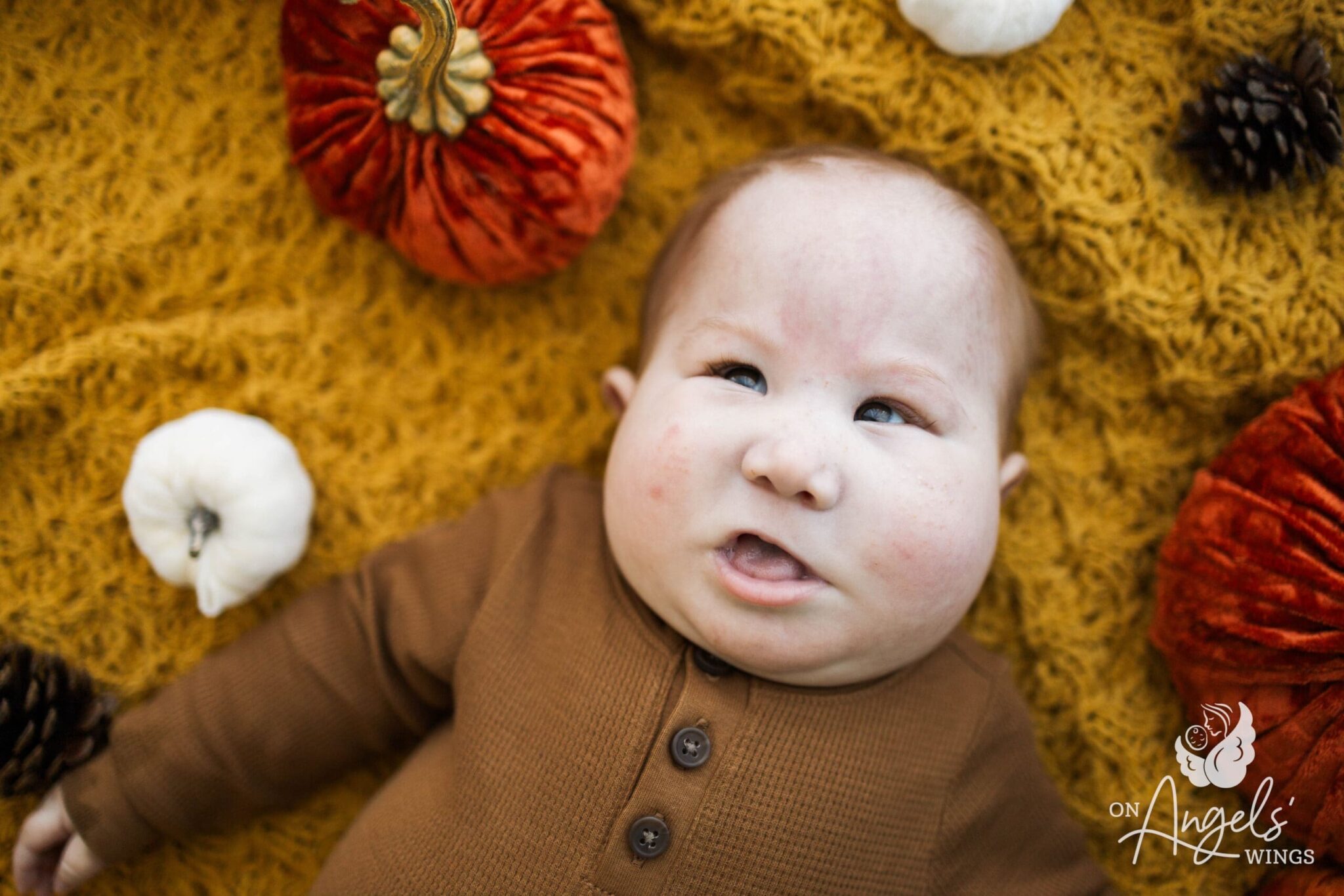 What are Trisomy 13 and Trisomy 18? - On Angels Wings